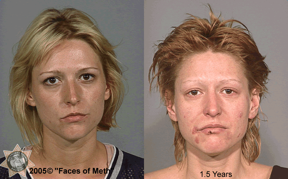 PHOTOS: Before and after mugshots of meth users | WJLA